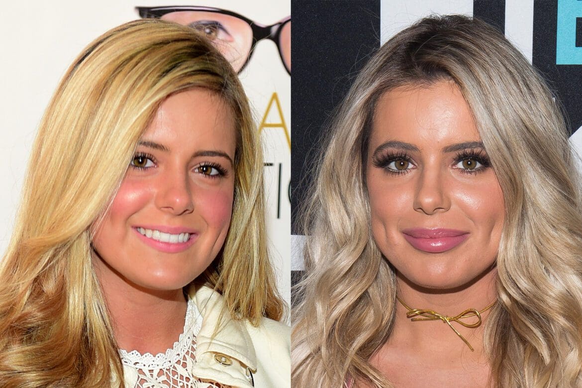 Brielle Biermann Admits She Went Overboard With Lip Filler